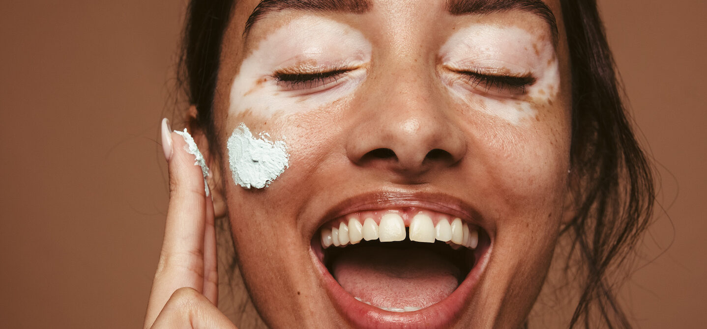 Dehydrated Skin Vs. Dry Skin: What’s the Difference? | HUM Nutrition Blog