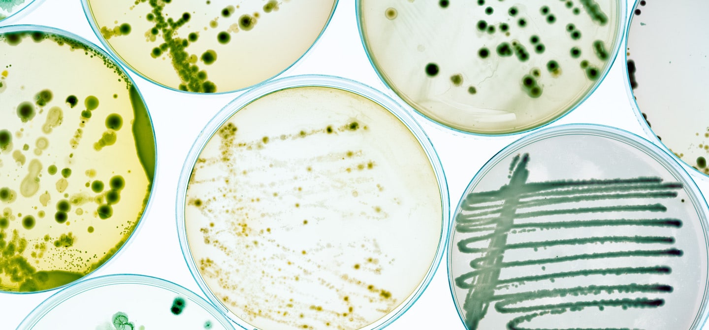Healthy Microbiomes: 12 Tips for Balanced Bacteria in Your Gut, Skin ...